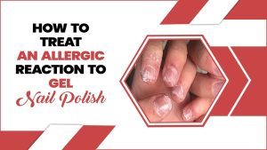 How To Treat An Allergic Reaction To Gel Nail Polish- Explain